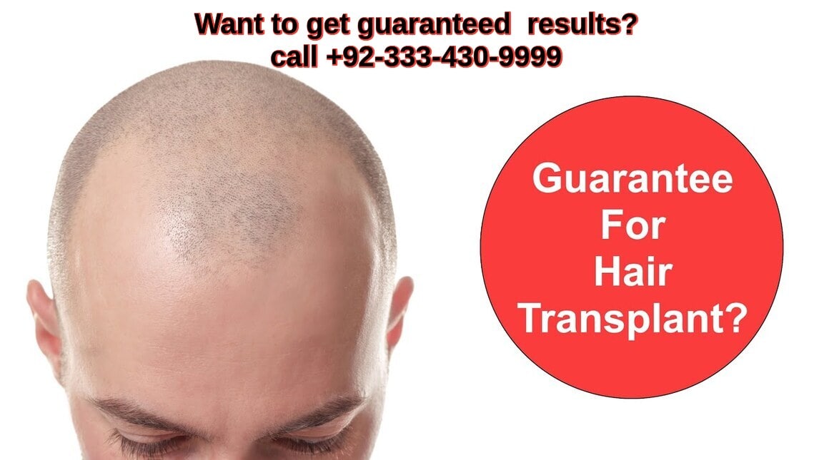 Hair Transplant Guarantee In Lahore Pakistan The Best Results